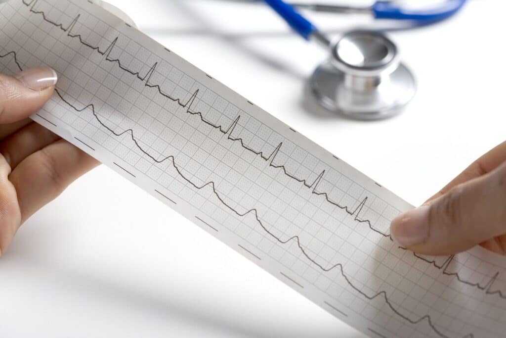 Alcohol & Heart Rate: Does Drinking Increase Cardiovascular Risk ...